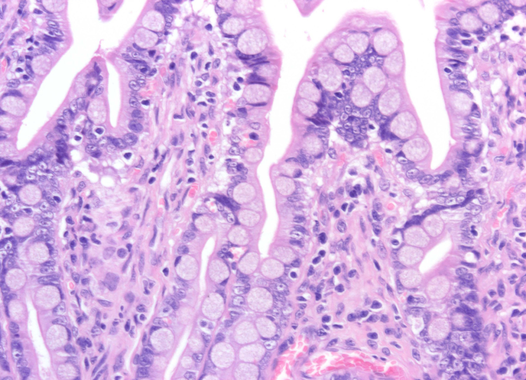 Yeyuno – DigestiveHistoLab.com